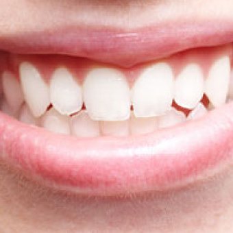 Woodbridge Dеntаl Саrе Тірs fоr Неаlthу Тееth